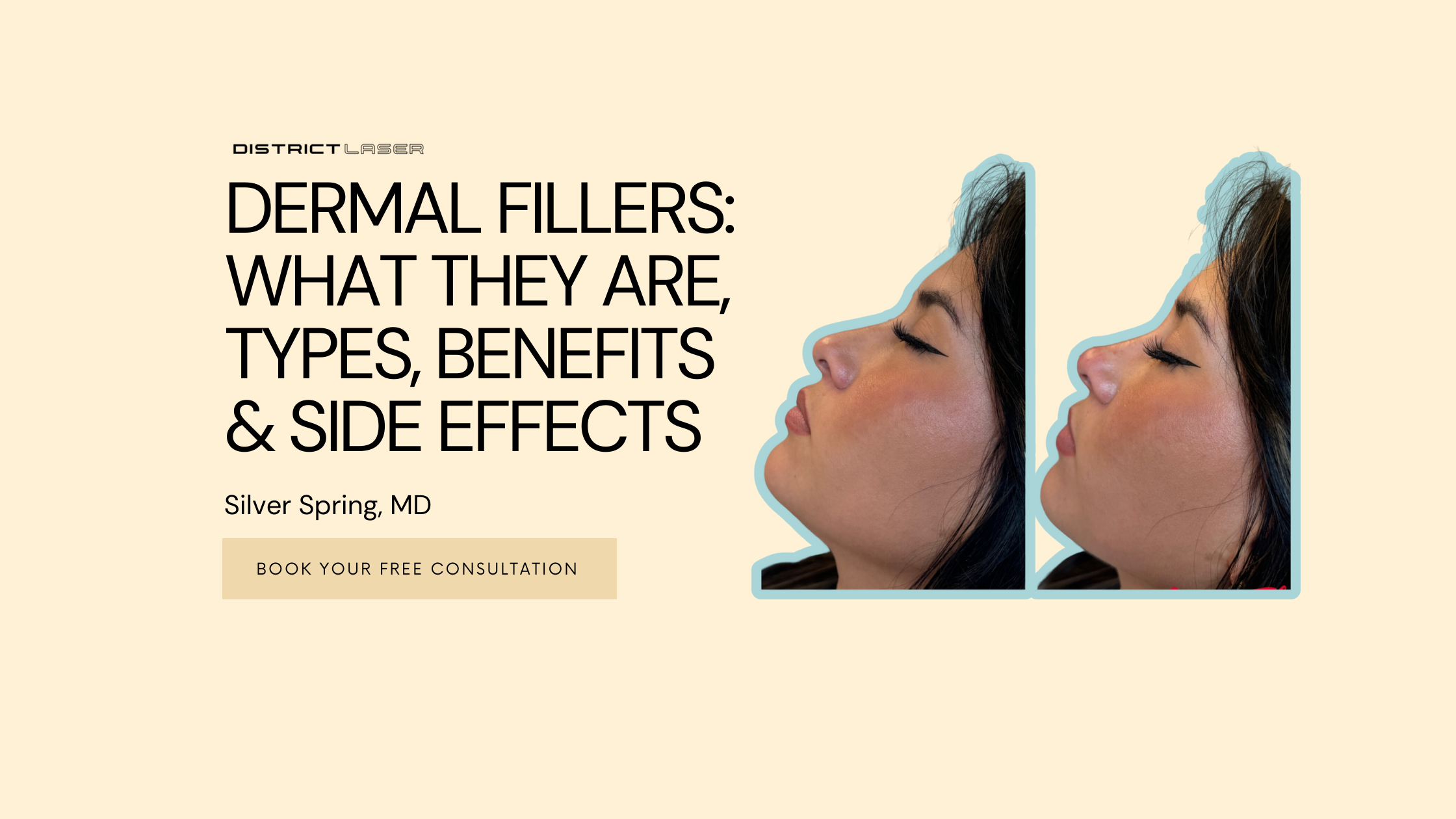 Dermal Fillers: What They Are, Types, Benefits & Side Effects ...